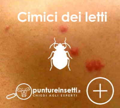 Riconoscere Punture Insetti Come Consigli Rimedi | PuntureInsetti